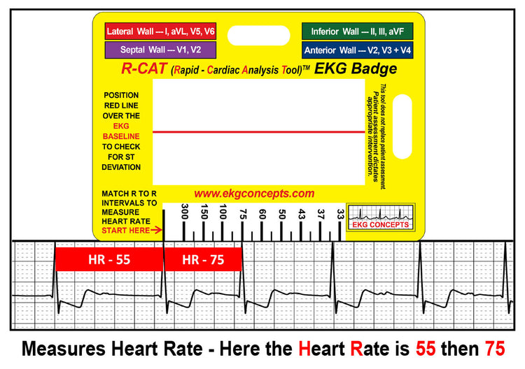 R-CAT EKG Badge - #3200 – EKG Concepts LLC